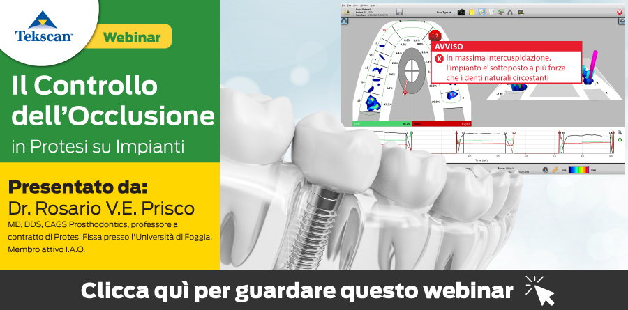 T-Scan in Italia | TScan | Tekscan T-Scan in Italia | TScan | Tekscan