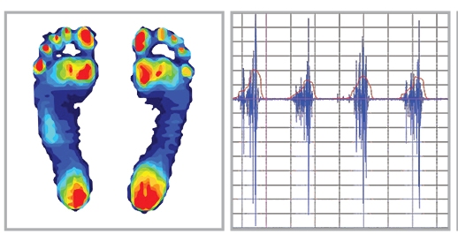 Gait Lab Equipment: Complementing EMG with Pressure Mapping | Tekscan