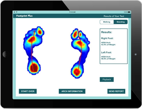 Retail Foot Mapping | Tekscan