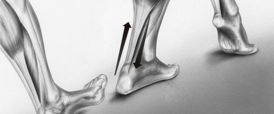 Analyze Foot Function with Pressure Mapping | Tekscan