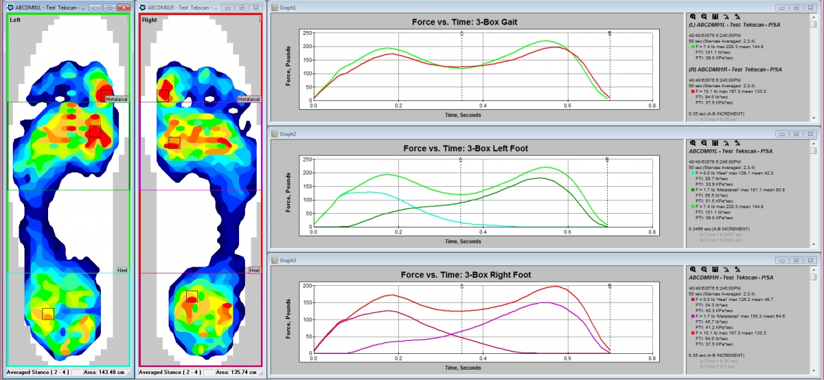 F-Scan System | Tekscan