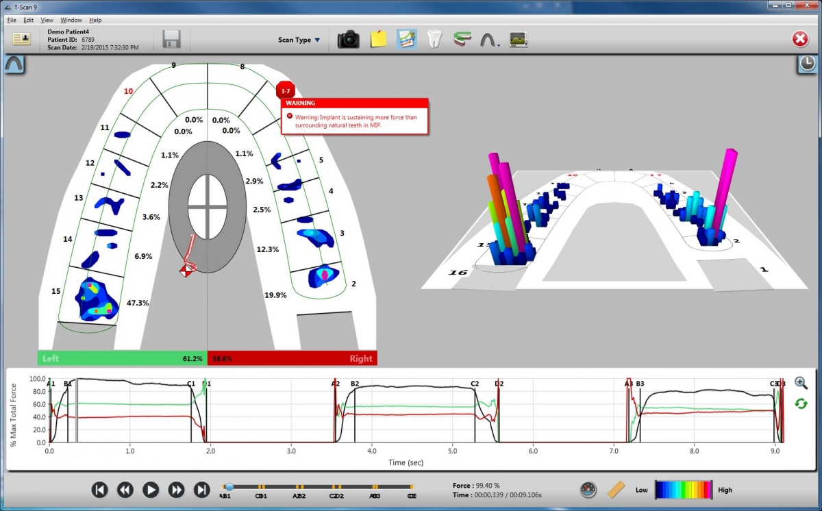 T-Scan Training Software 9.0 | Tekscan