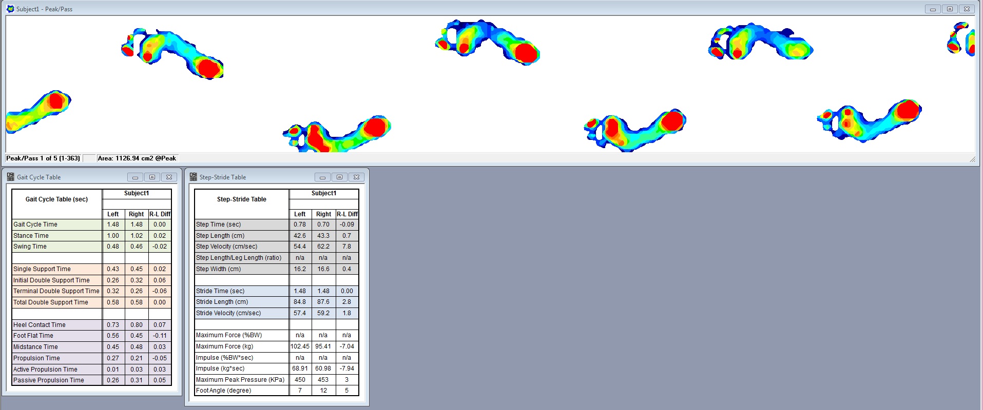 What Information Does a Tekscan Gait Analysis System Provide? | Tekscan