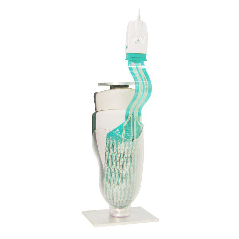 Pressure Mapping in Prosthetics | Tekscan