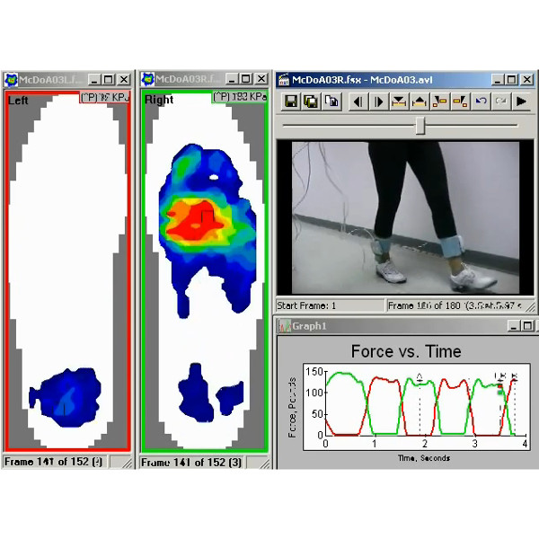 Video Synchronization Software Module add-on | Tekscan